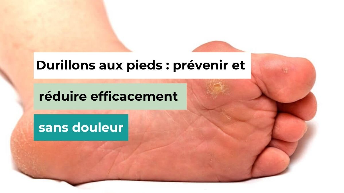 Prévenir et réduire les durillons : solutions efficaces sans douleur ...