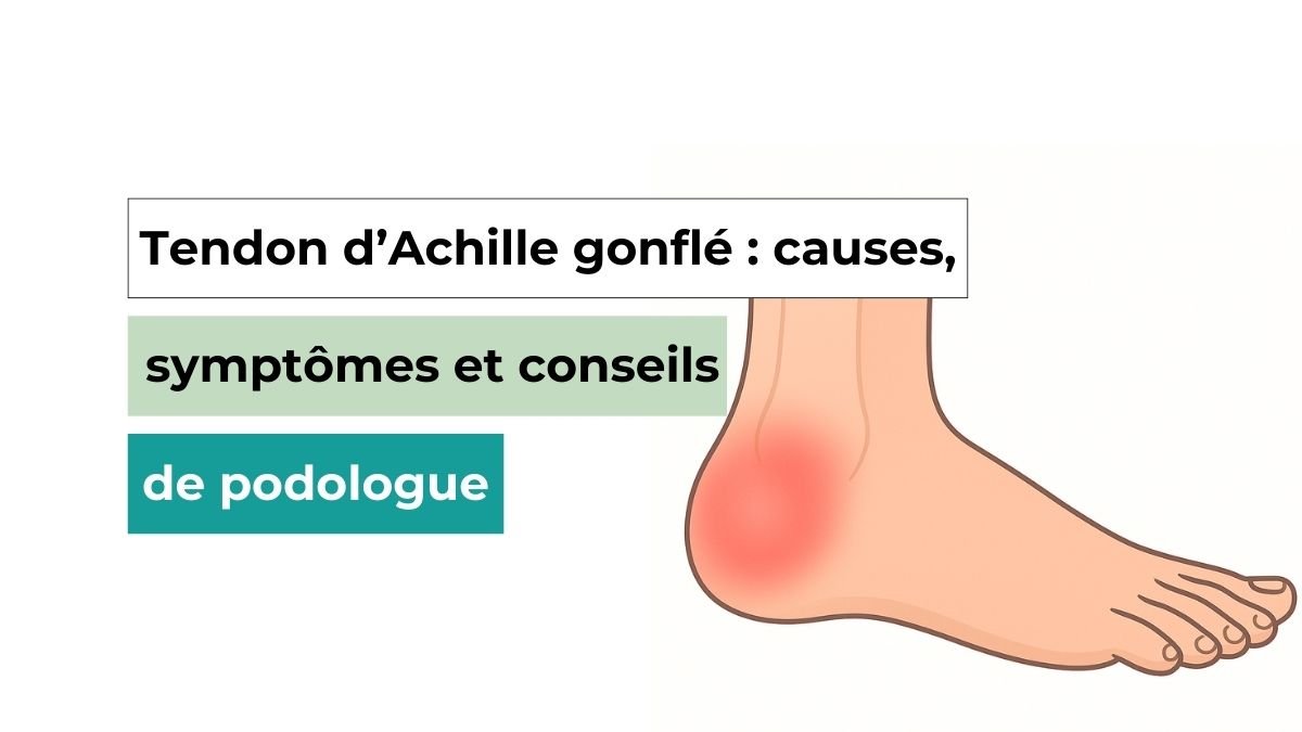 Tendon d’Achille gonflé : causes, symptômes et conseils podologue ...
