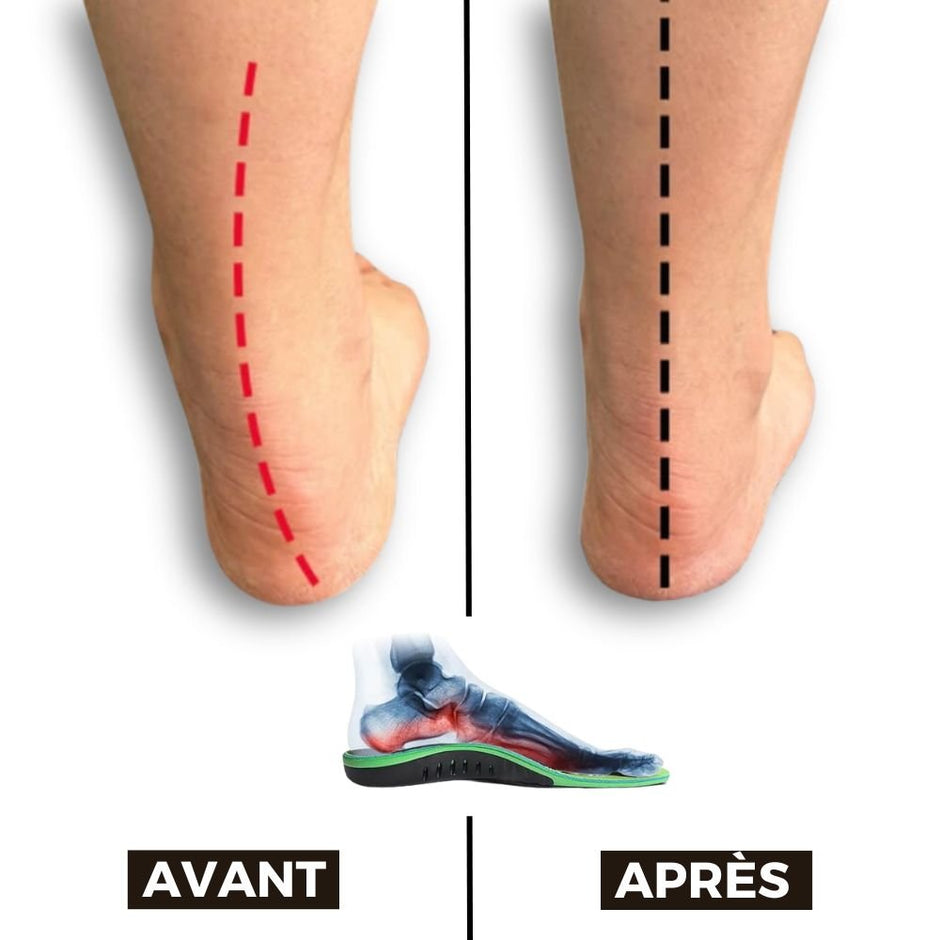 Semelle Orthopédique - Confort et Soutien｜Semello™ – Semello.fr